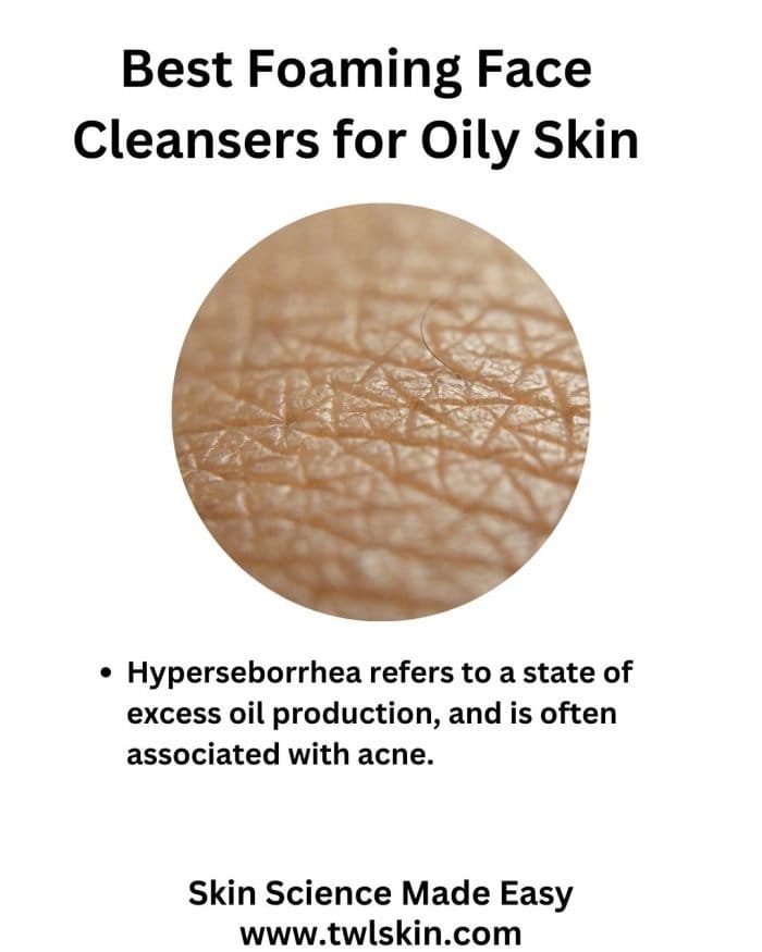 The 1 Best Foam Cleanser for Oily Skin—Dermatologist’s DIY Home Facial ...