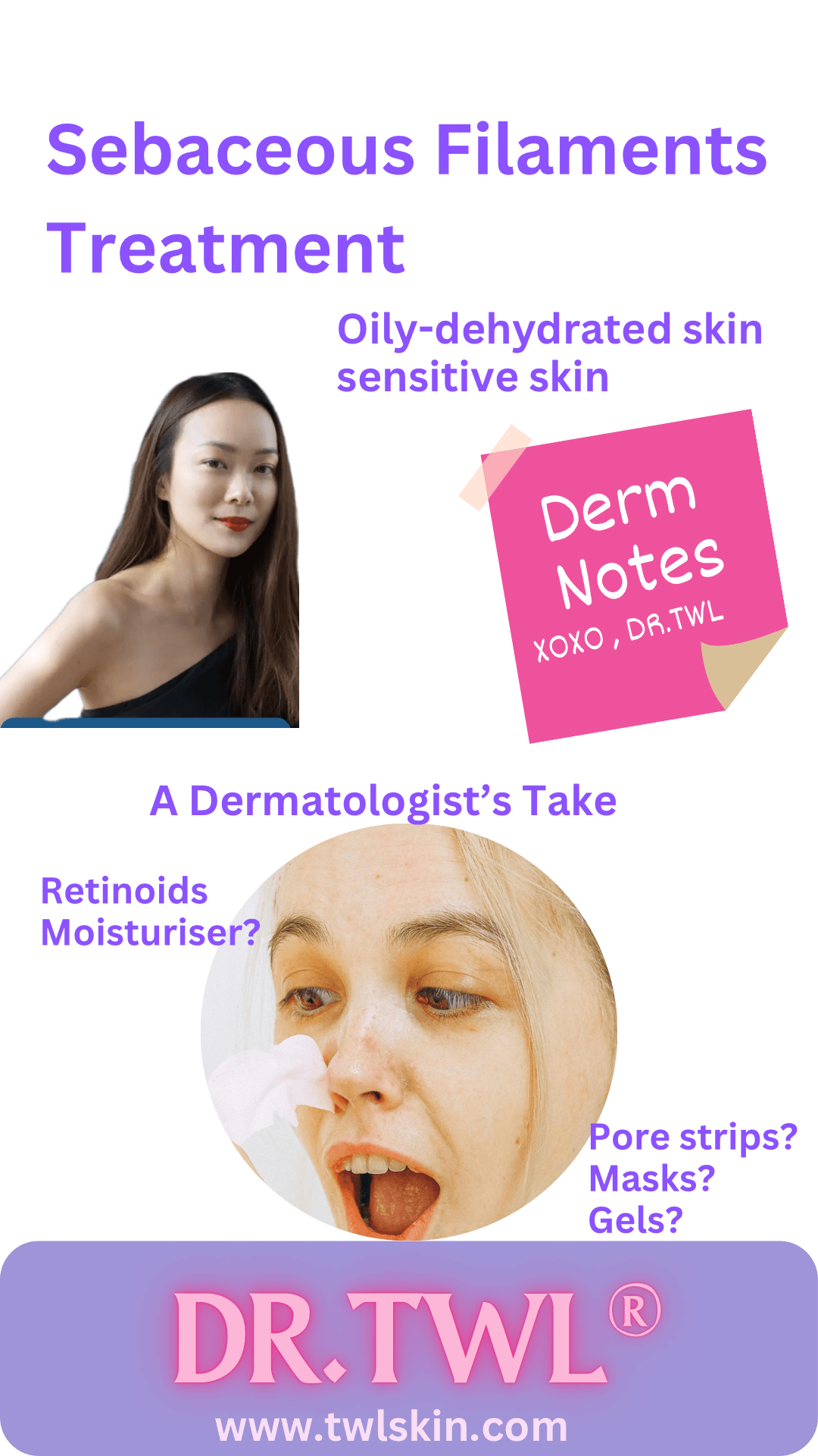 Sebaceous Filaments Treatment—A Dermatologist’s Take